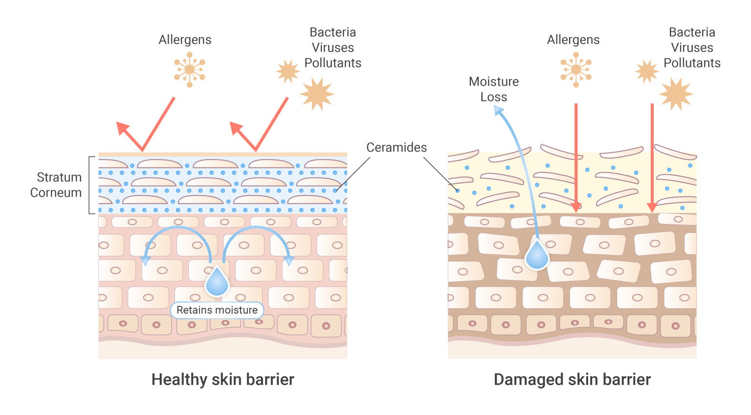 What *Exactly* is Your Skin Barrier and Why Does it Matter?