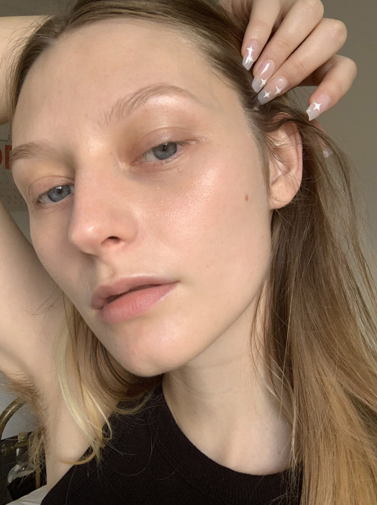How My Rosacea Journey Sent me TikTok Viral