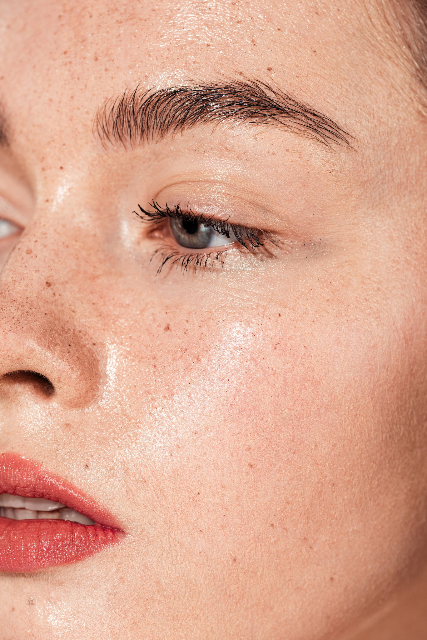 Blackheads: What Are they (and How Do You Get Rid of Them)?